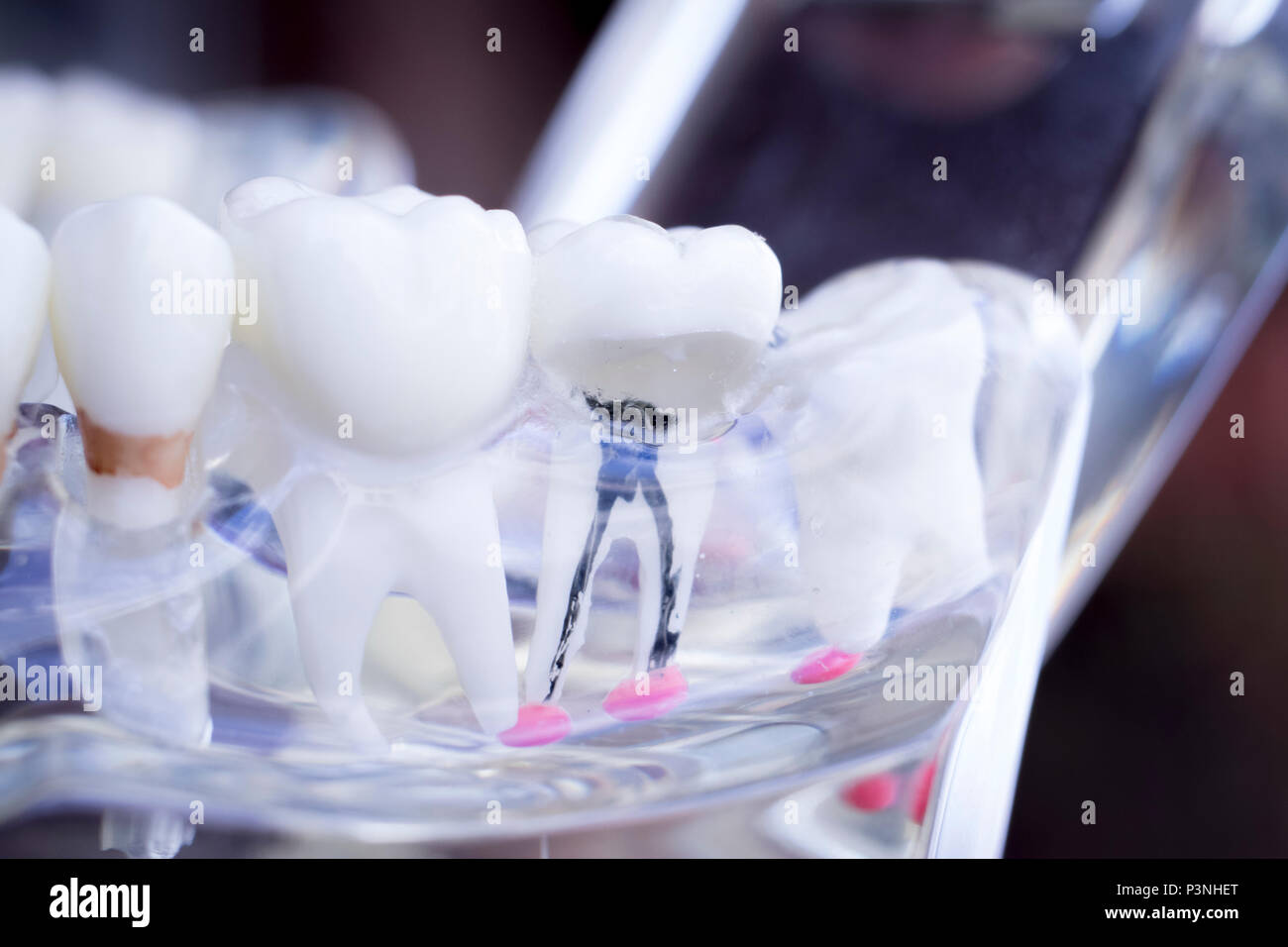 Dentist dental teeth teaching model showing each tooth and gum for ...