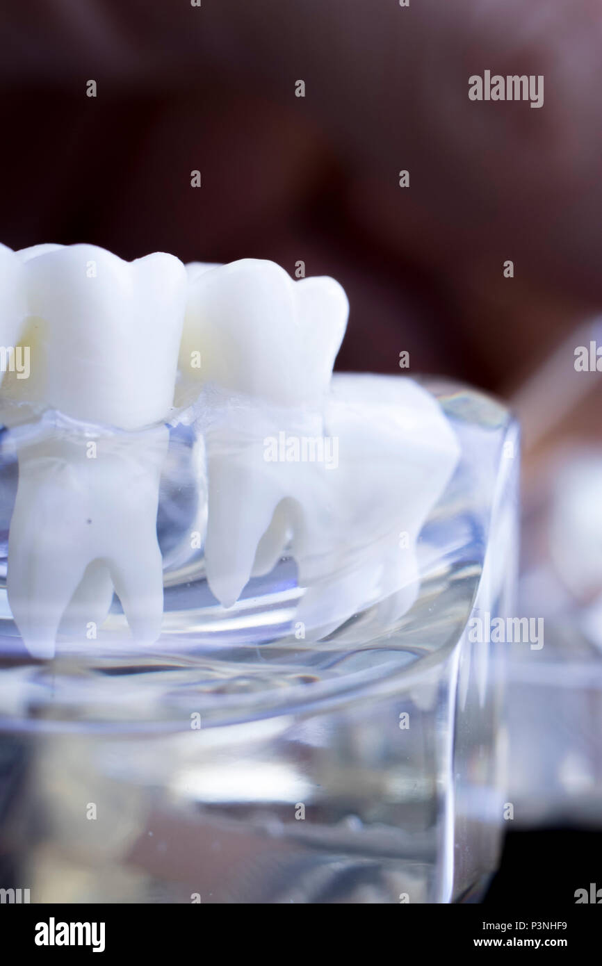 Dentist dental teeth teaching model showing each tooth and gum for ...