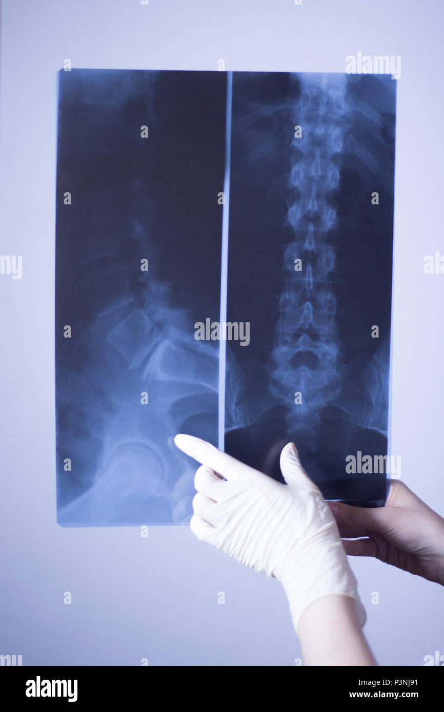 Medical hospital x-ray lowe back pain spine and hips traumatology scan ...