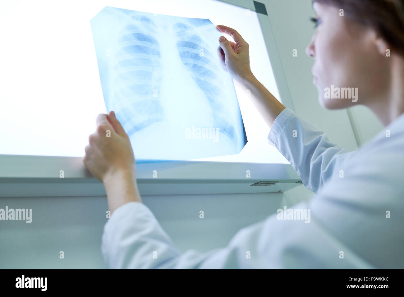 Woman chest x ray hi-res stock photography and images - Alamy