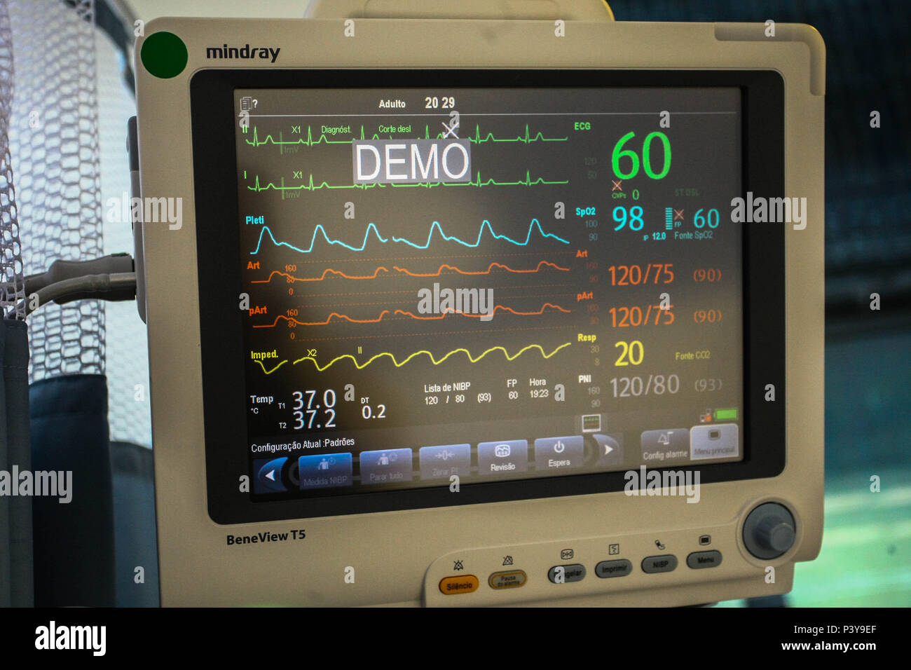 Na foto Monitor cardíaco hospitalar Stock Photo - Alamy