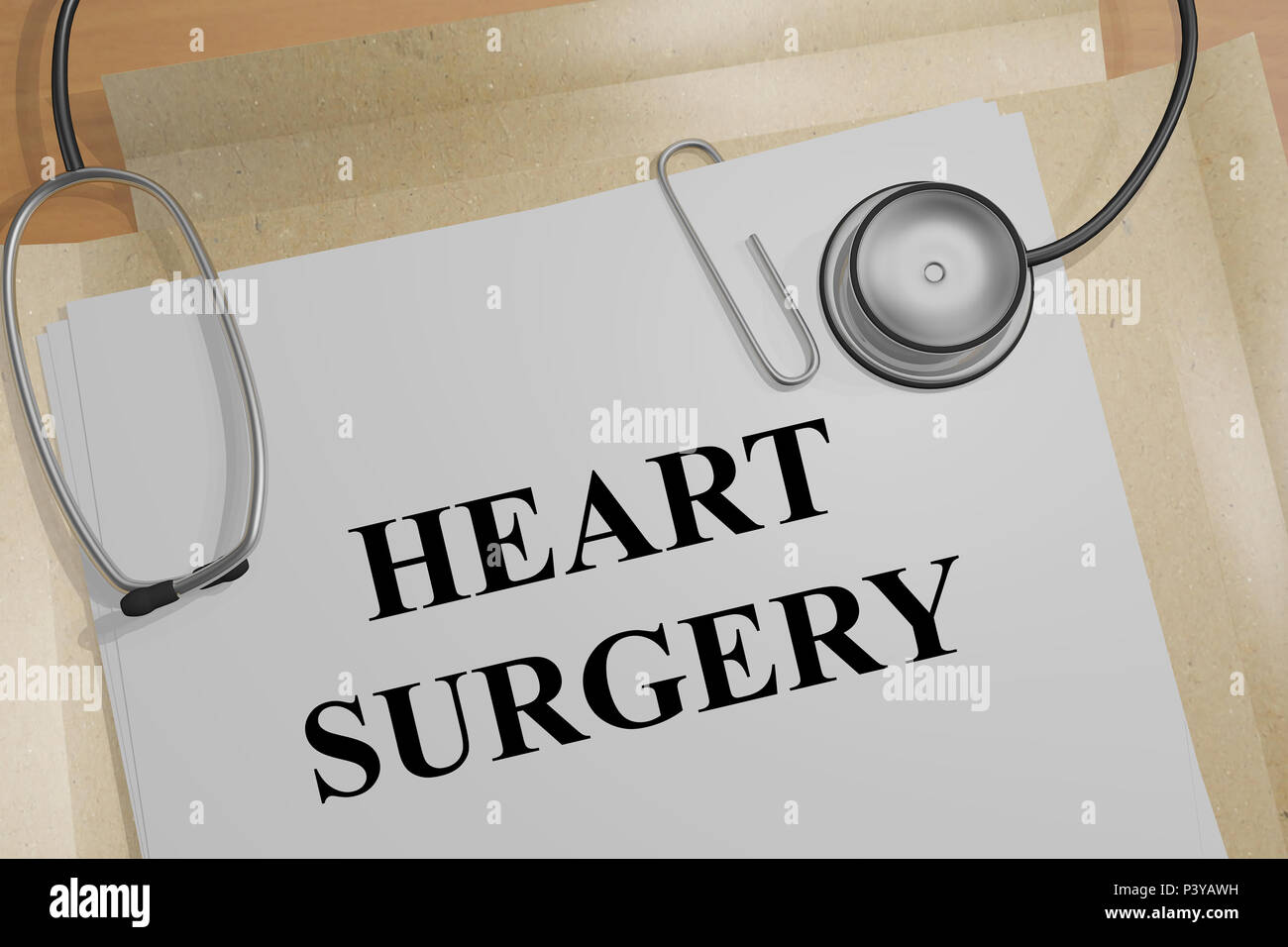 3D illustration of HEART SURGERY title on a medical document Stock ...