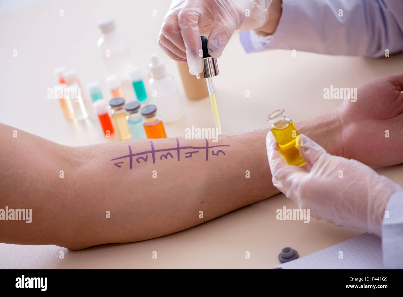 Doctor testing allergy reaction of patient in hospital Stock Photo - Alamy