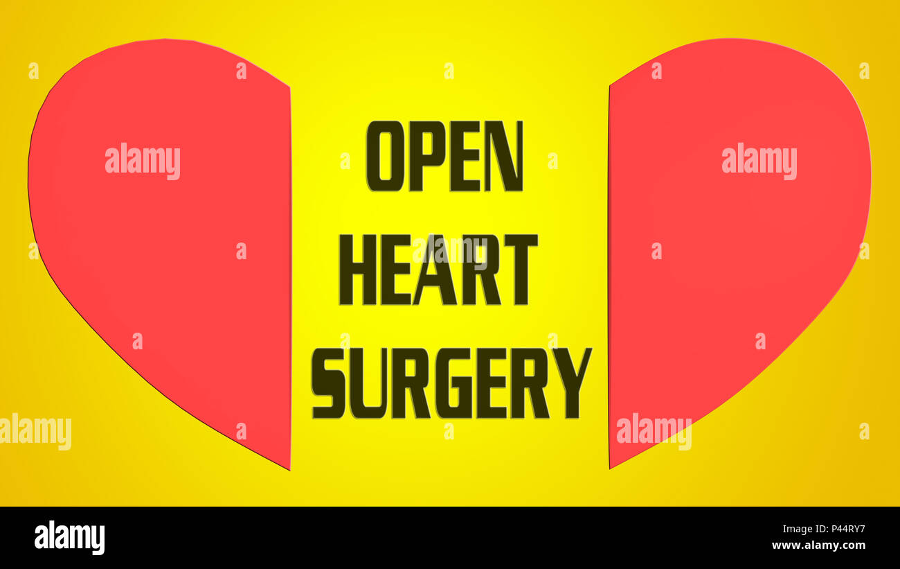 3D illustration of OPEN HEART SURGERY between red split heart, isolated ...