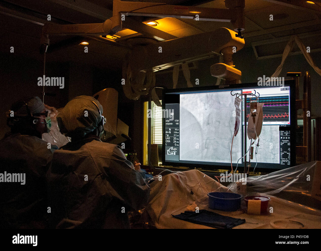 Coronary catheterization hi-res stock photography and images - Alamy