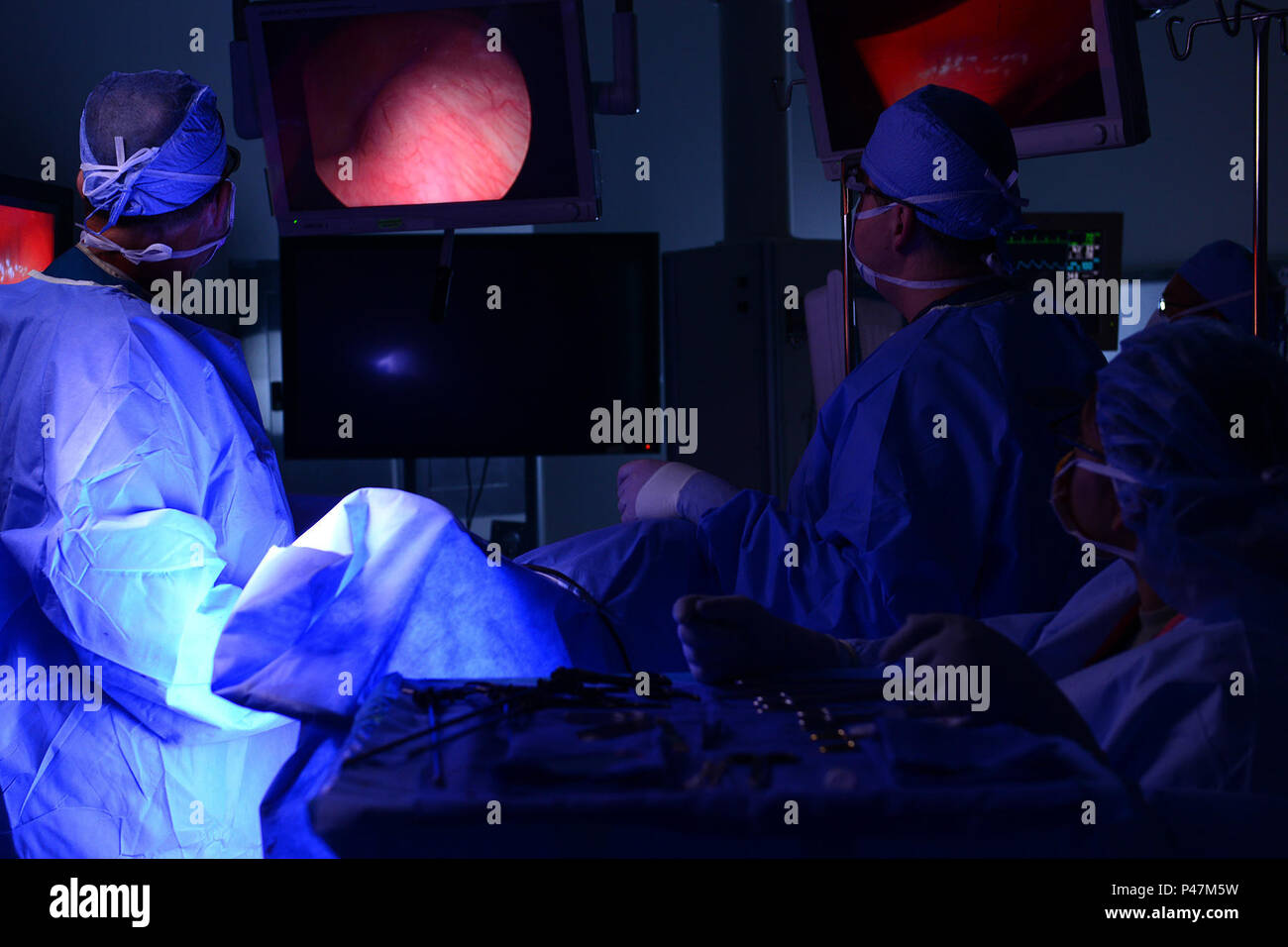 Laparoscopic hysterectomy hi-res stock photography and images - Alamy