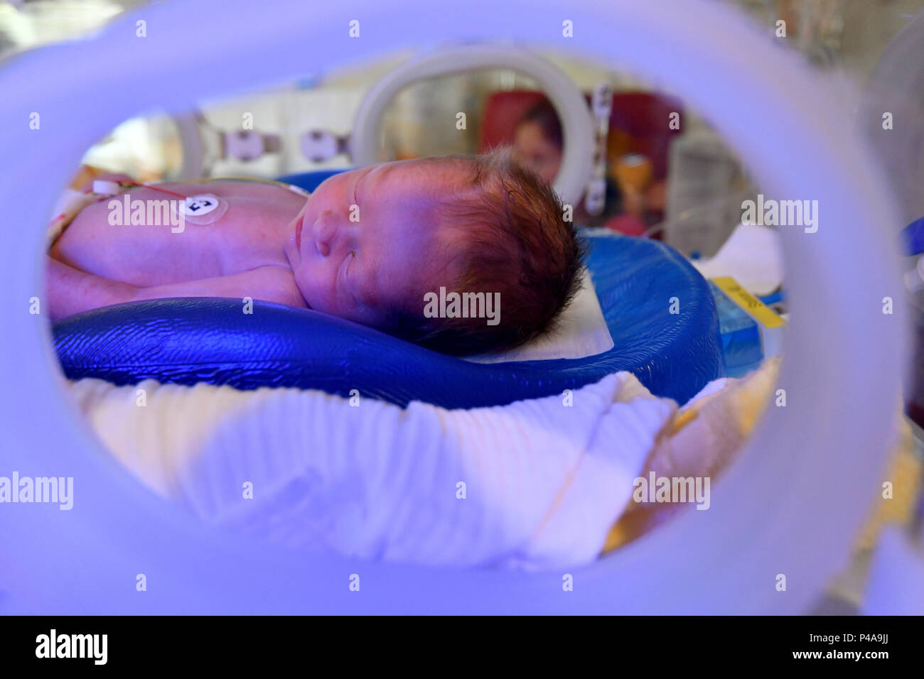 Germany, Berlin. 21st June, 2018. The premature baby Stefan, born June ...