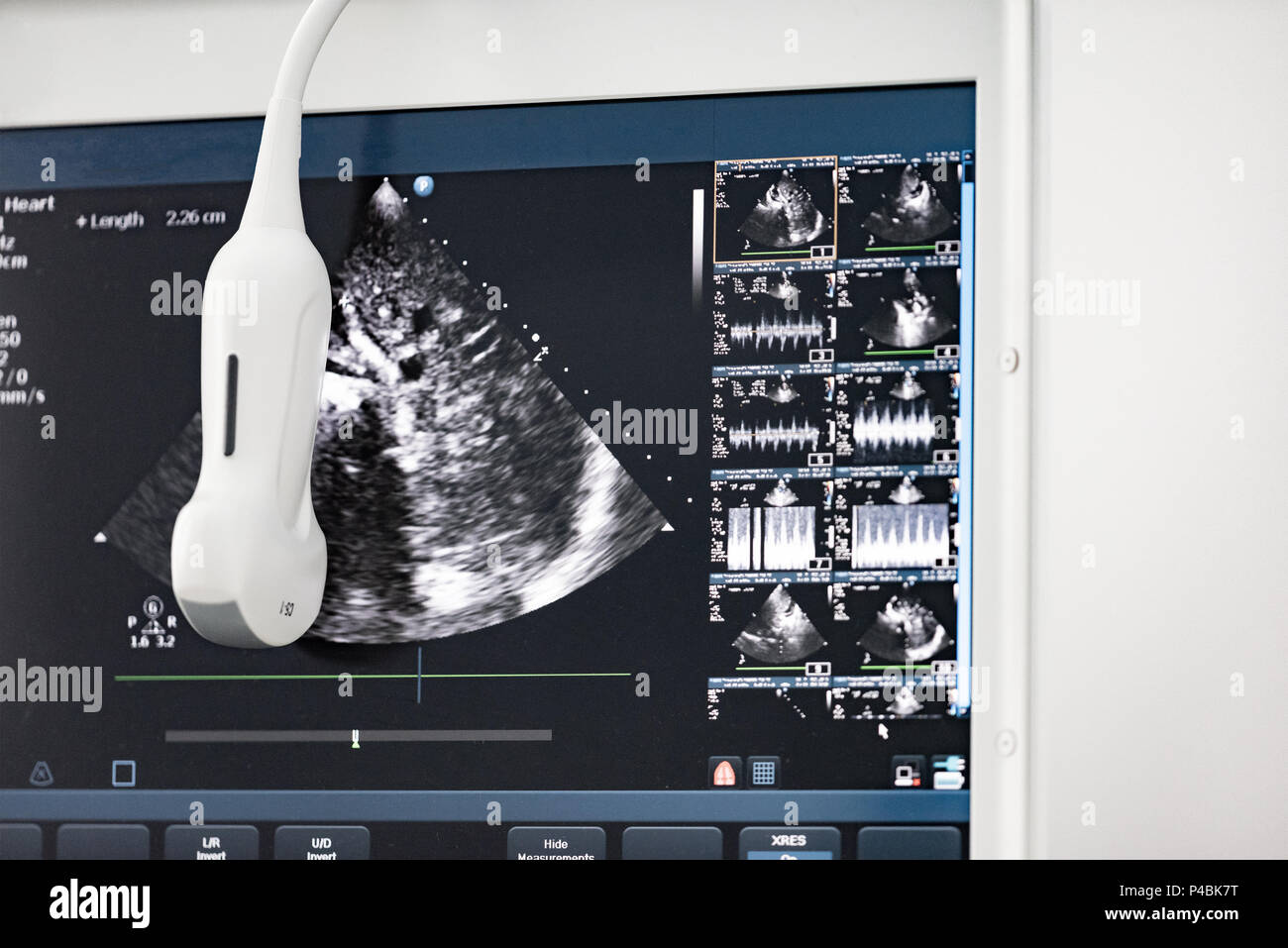 The ultrasound monitor with a picture and a sensor that hangs at the ...