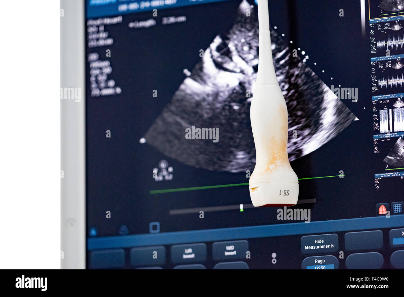 The ultrasound monitor with a picture and a sensor that hangs at the ...