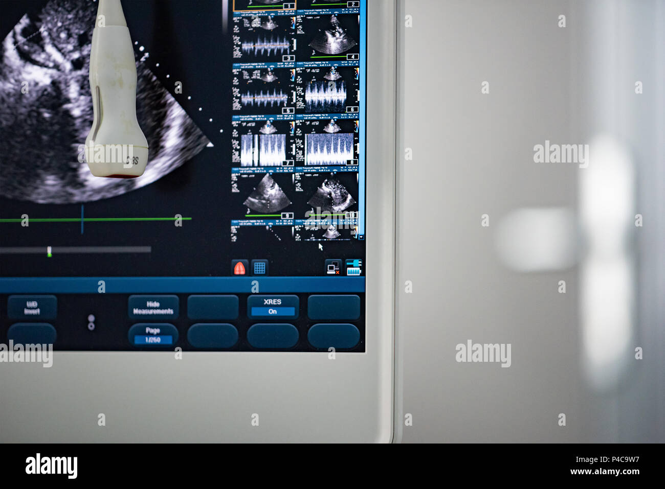 The ultrasound monitor with a picture and a sensor that hangs at the ...