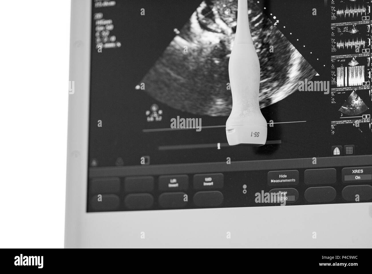 A monitor of an ultrasound device with a picture and a sensor that ...