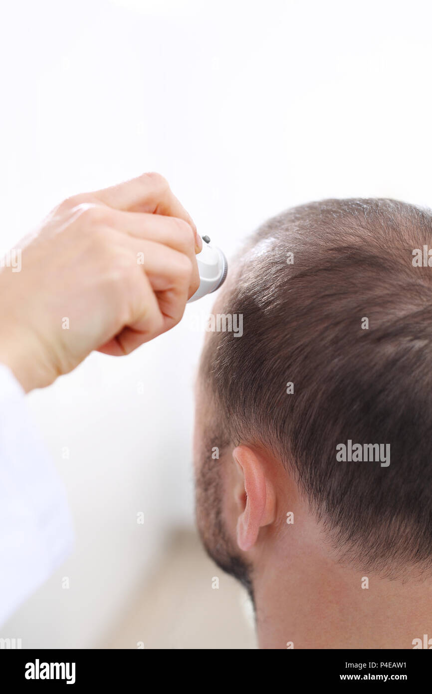 Needle mesotherapy scalp microneedle hi-res stock photography and ...