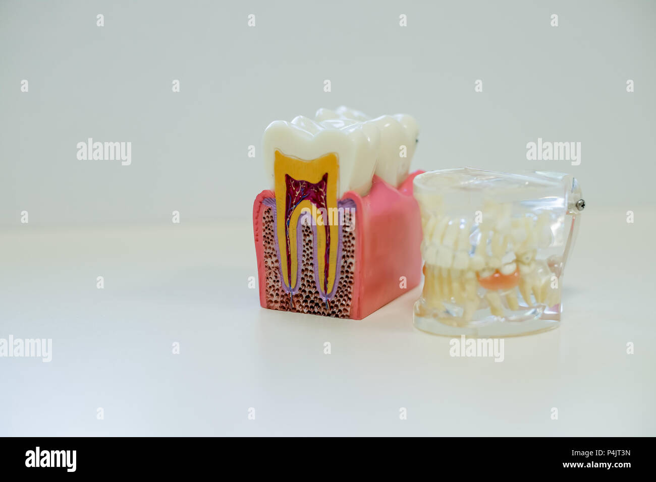 White teeth model and tooth model without caries on white background ...