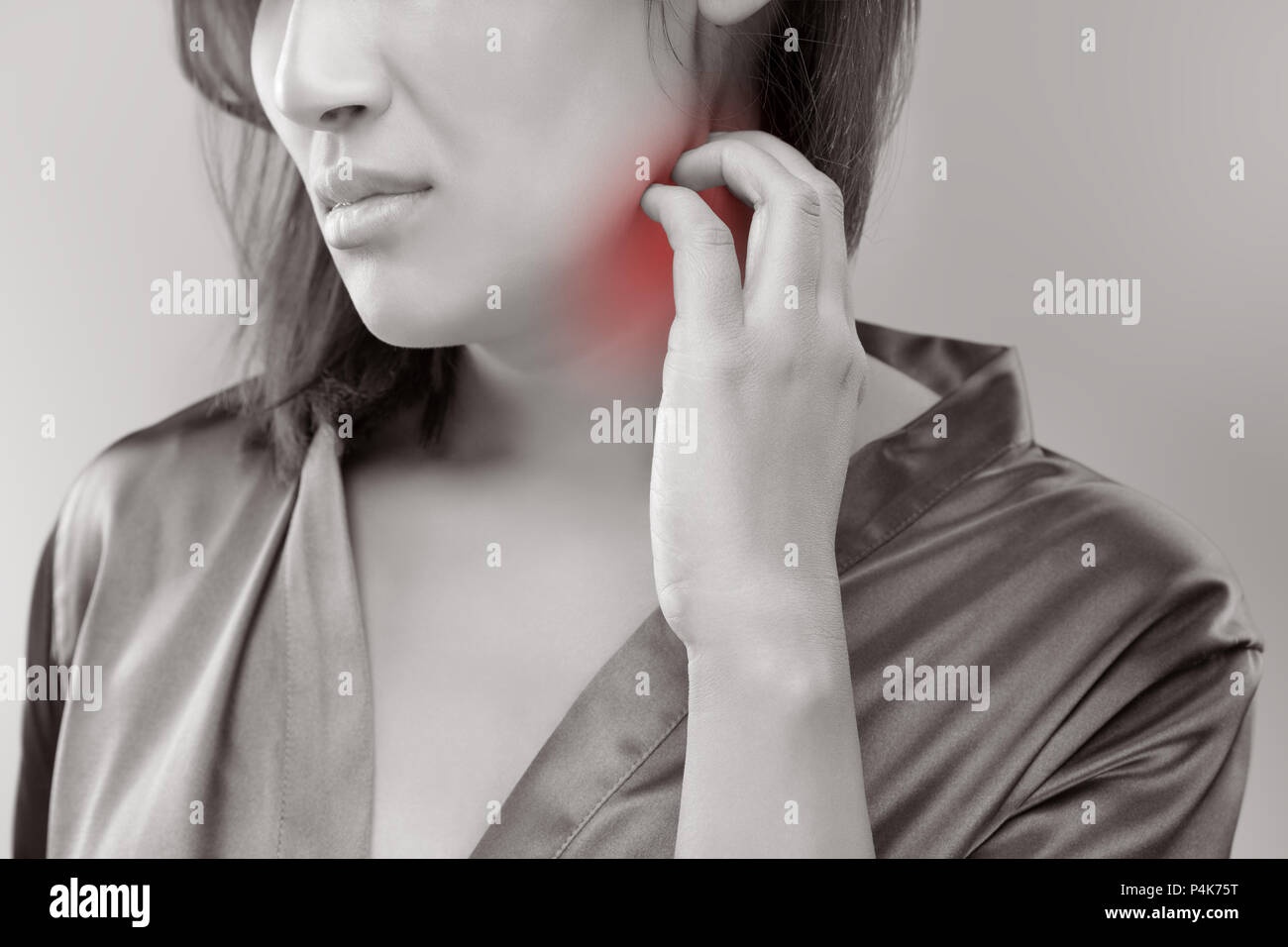 Beautiful women itching and scratching by hand, Closeup, Healthcare And ...