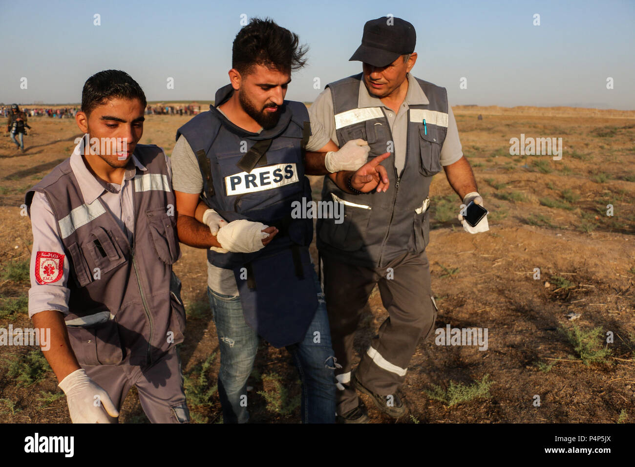 Shrapnel injury hi-res stock photography and images - Alamy