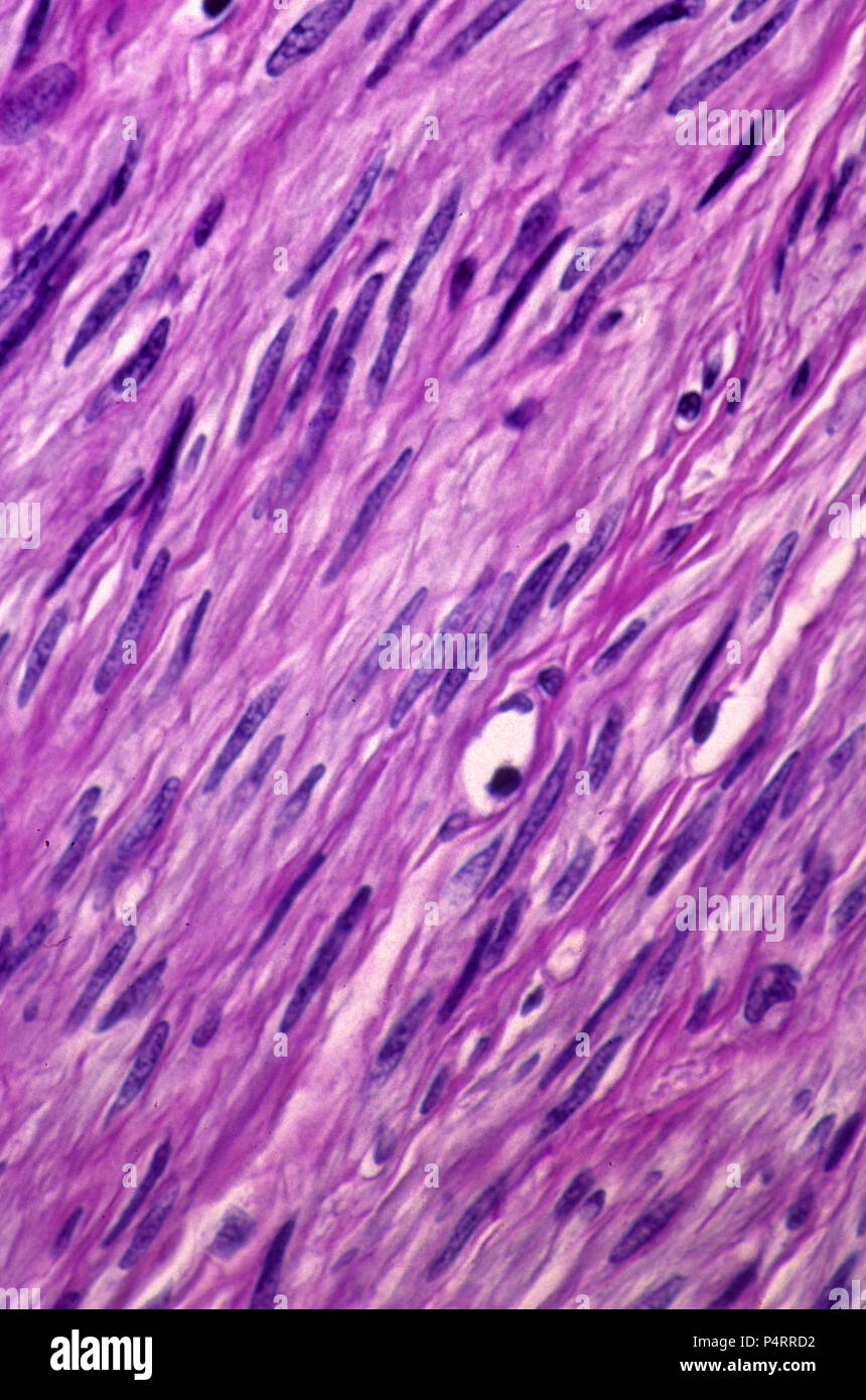 Muscle cells hi-res stock photography and images - Alamy