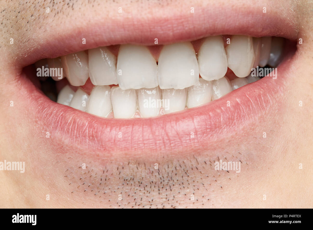 Male Teeth Smile
