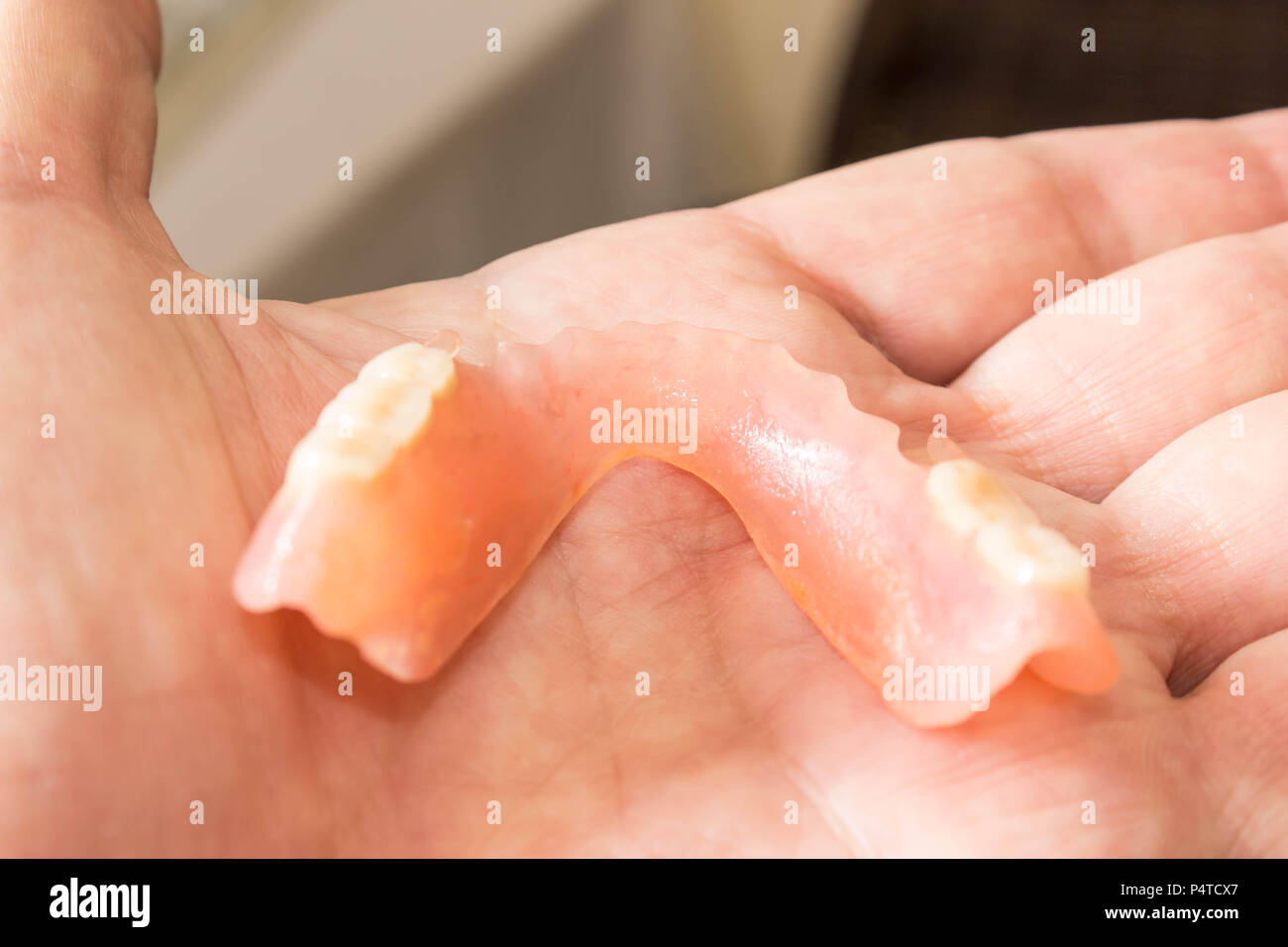 flexible nylon denture Stock Photo - Alamy