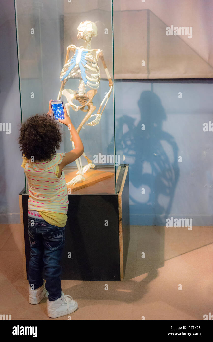 how did turkana boy die