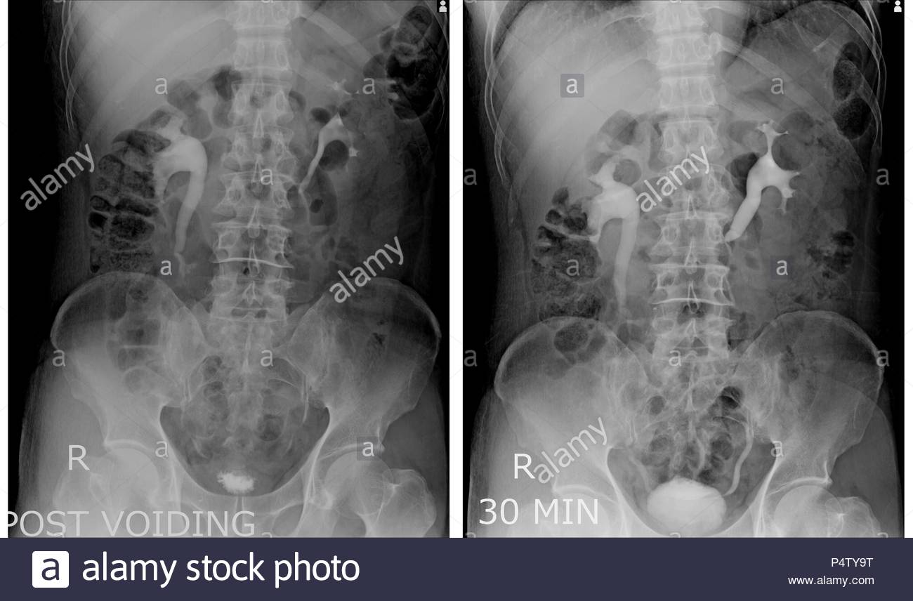 Pelvic Exam Stock Photos & Pelvic Exam Stock Images - Alamy