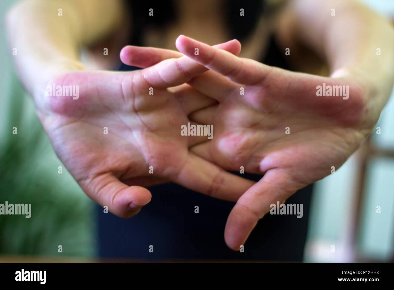 Cracking knuckles hi-res stock photography and images - Alamy