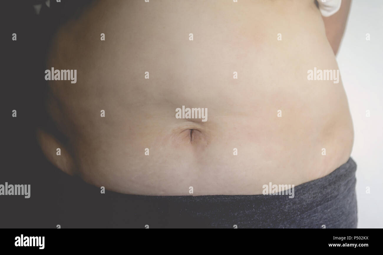 Close-up of human body and fat body, Fat body part of paunch or belly ...