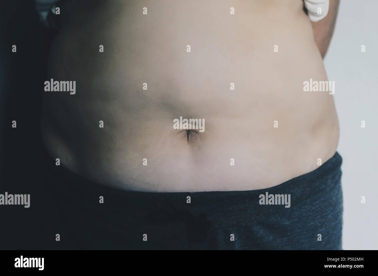 Close-up of human body and fat body, Fat body part of paunch or belly ...