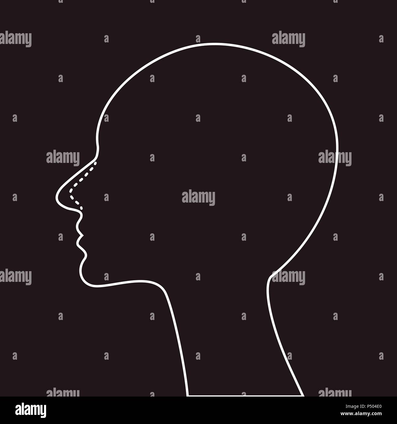 Rhinoplasty, nose plastic surgery, aesthetic medicine Vector ...