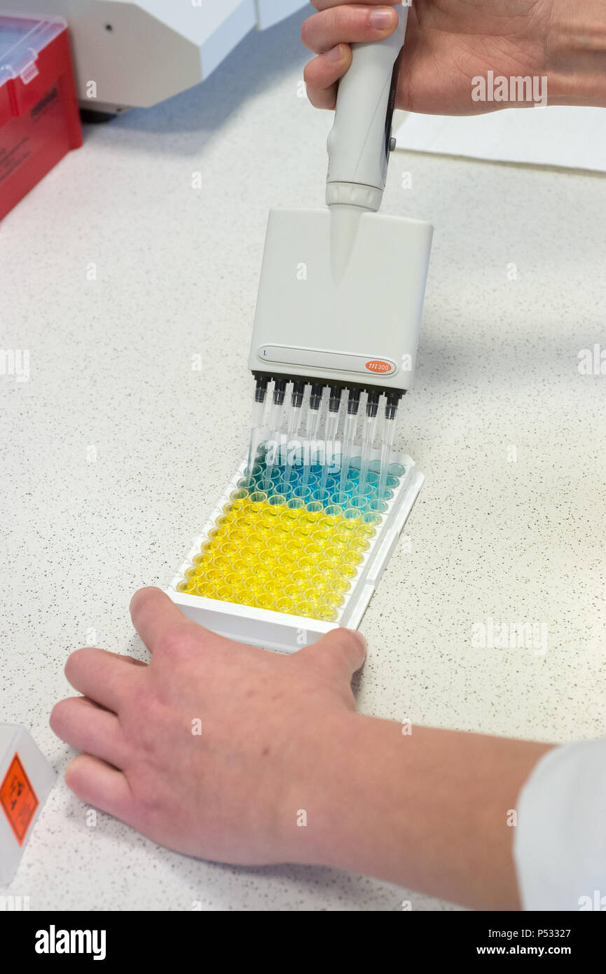 Preparation samples within elisa diagnostics hi-res stock photography ...