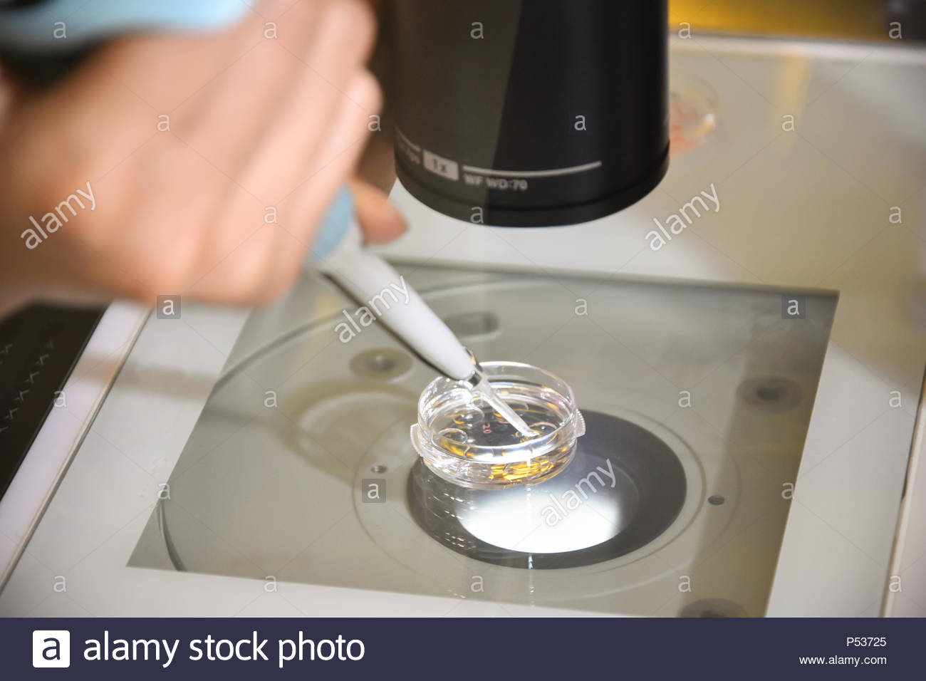 Embryo Transfer Stock Photos & Embryo Transfer Stock Images - Alamy
