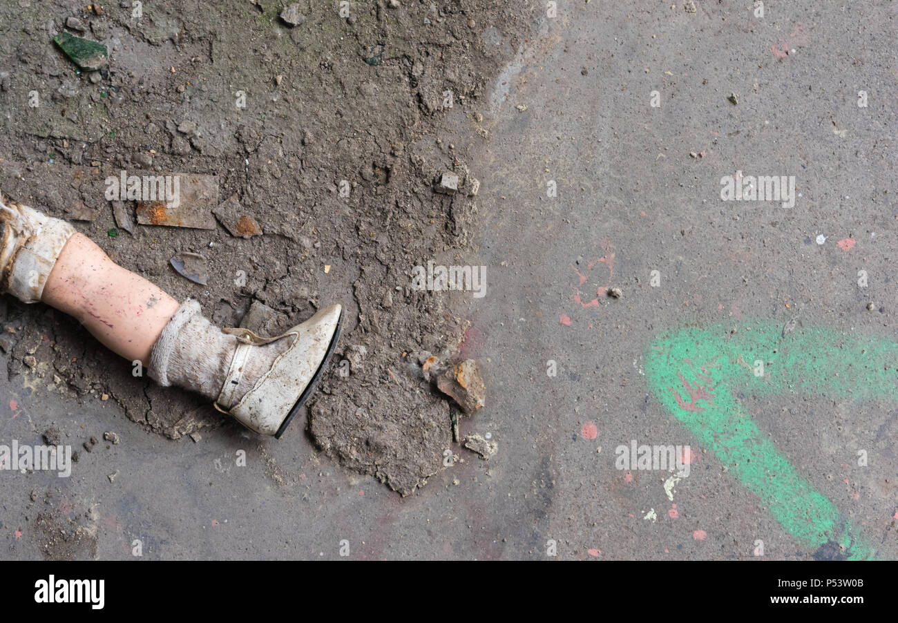 Missing body part hi-res stock photography and images - Alamy