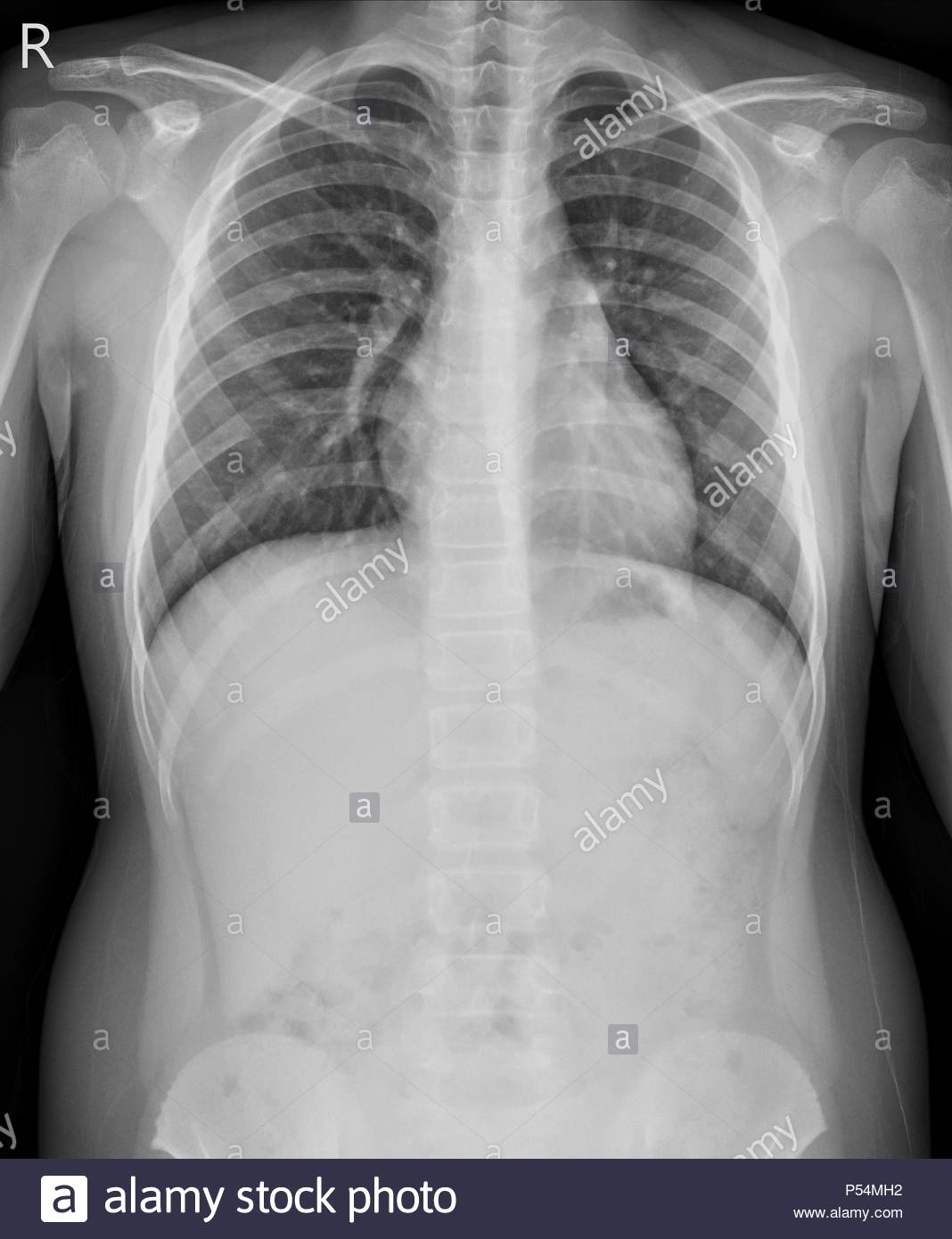 Chest Anatomy Stock Photos & Chest Anatomy Stock Images - Alamy