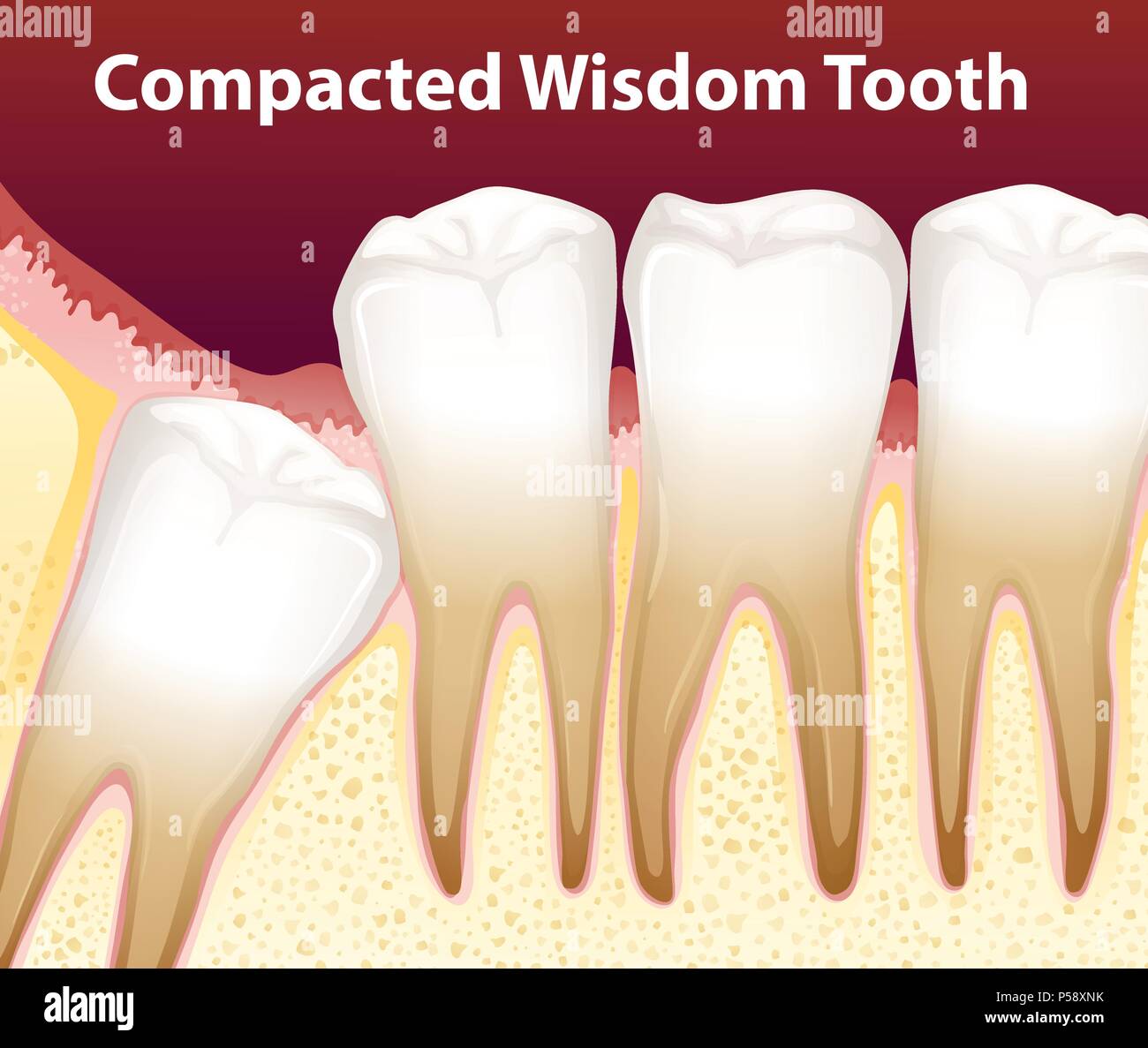 Wisdom tooth vector vectors hi-res stock photography and images - Alamy