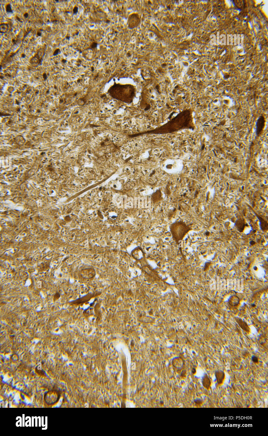 Nerve cell micrograph hi-res stock photography and images - Alamy