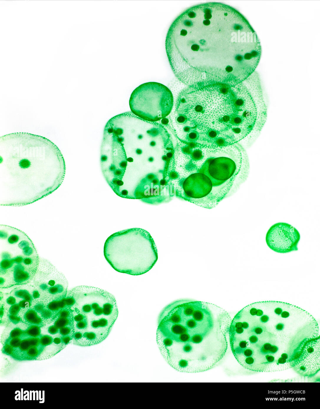Volvox a polyphyletic genus of chlorophyte green algae Stock Photo - Alamy