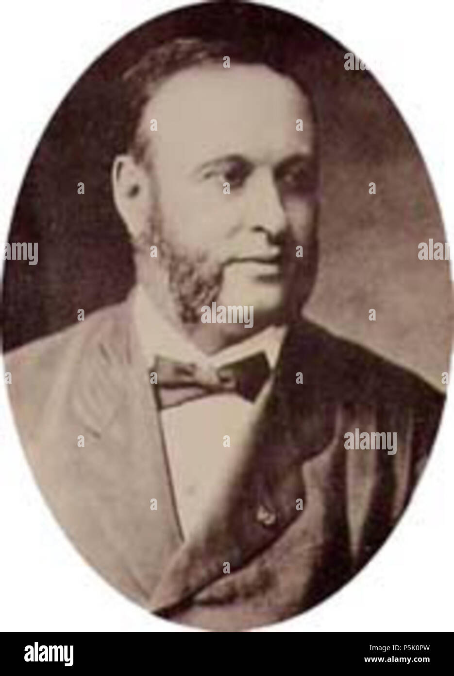 N/A. Dr Maurice Raynaud, who discovered Raynaud's phenomenon. Unknown ...