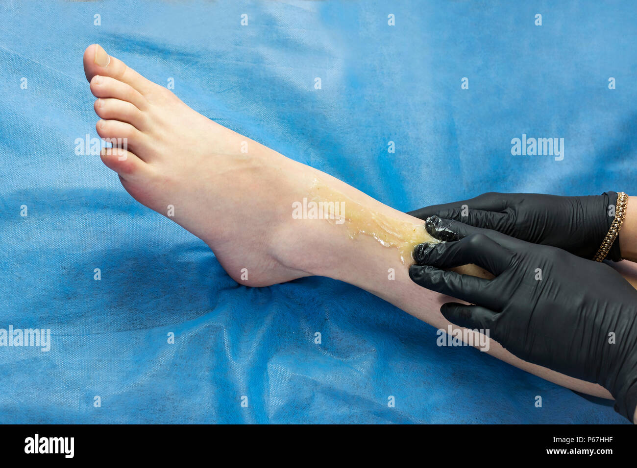 Depilation sugar processes woman passes in a beauty salon Stock Photo ...