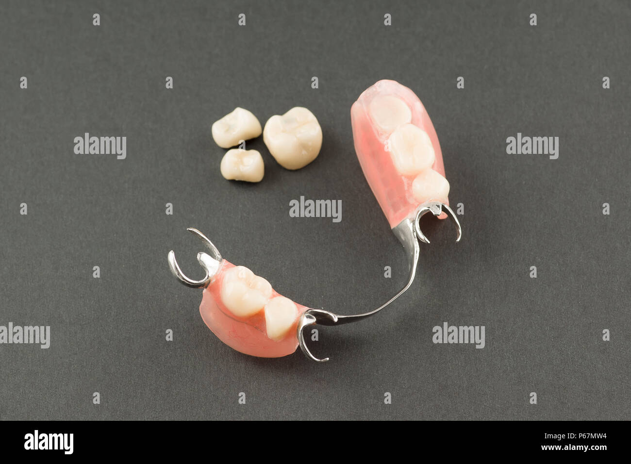 large image of a modern denture on a black background Stock Photo - Alamy