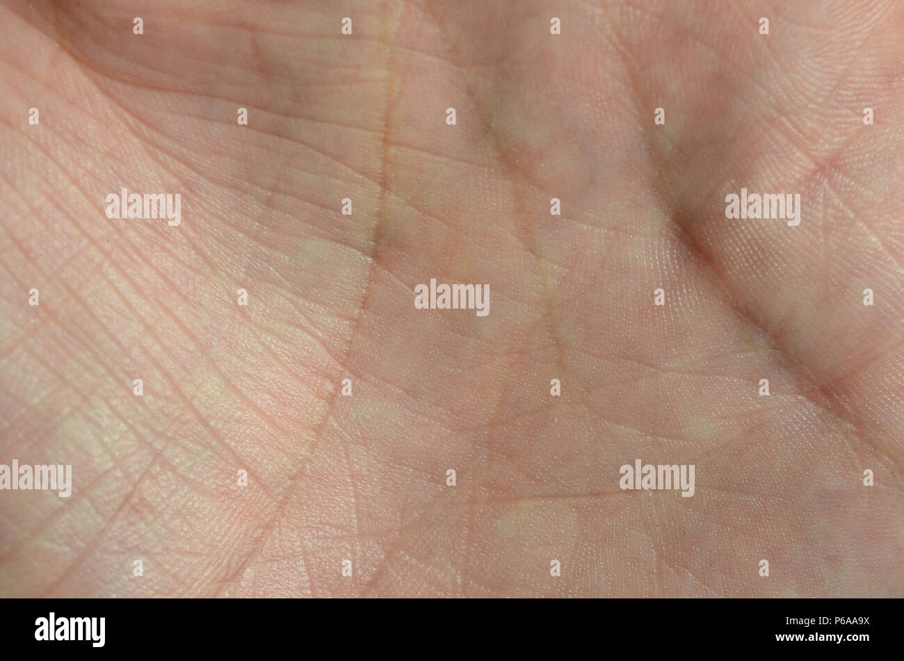 Hand skin hi-res stock photography and images - Alamy