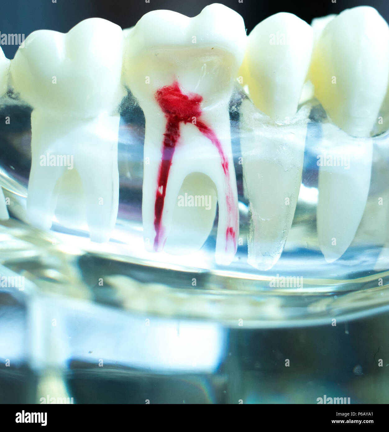 Dentist dental teeth teaching model showing each tooth and gum for ...