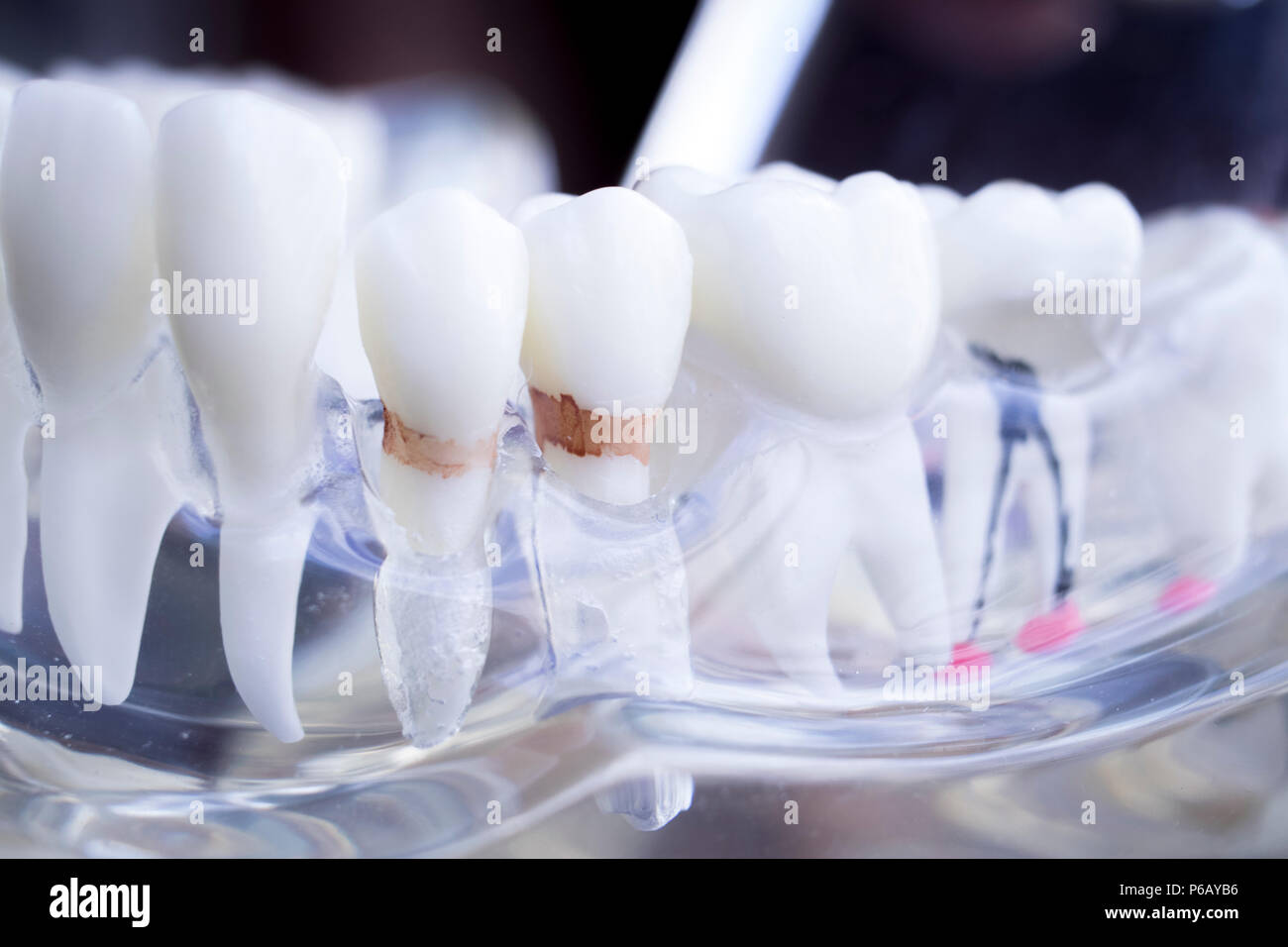 Dentist dental teeth teaching model showing each tooth and gum for ...