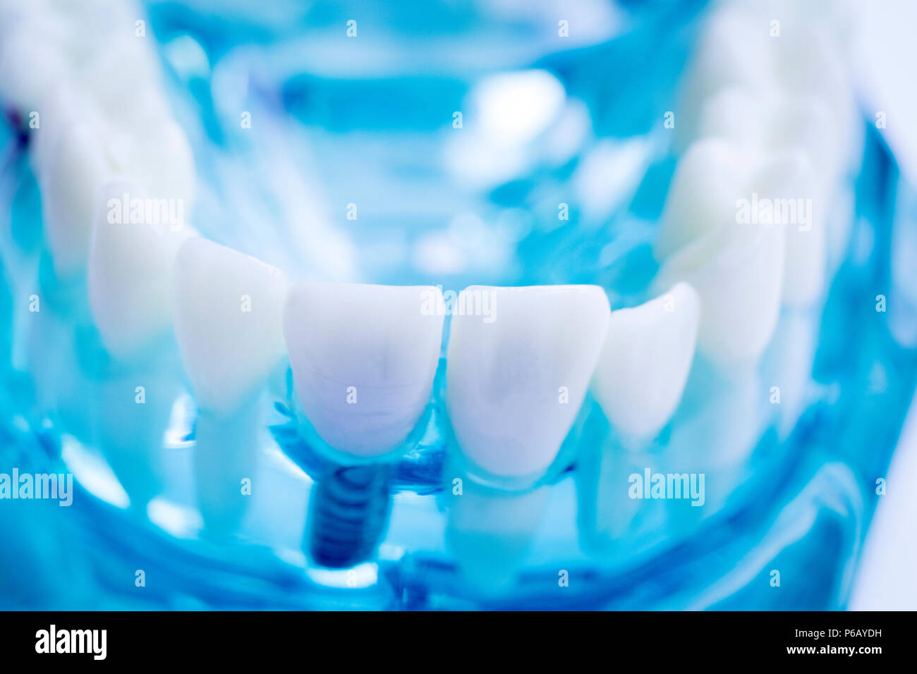 Dentist dental teeth teaching model showing each tooth and gum for ...