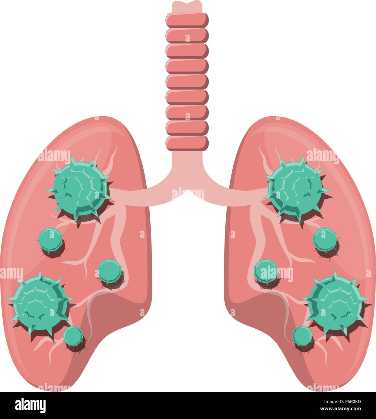 Lungs with an infection over white background, vector illustration ...