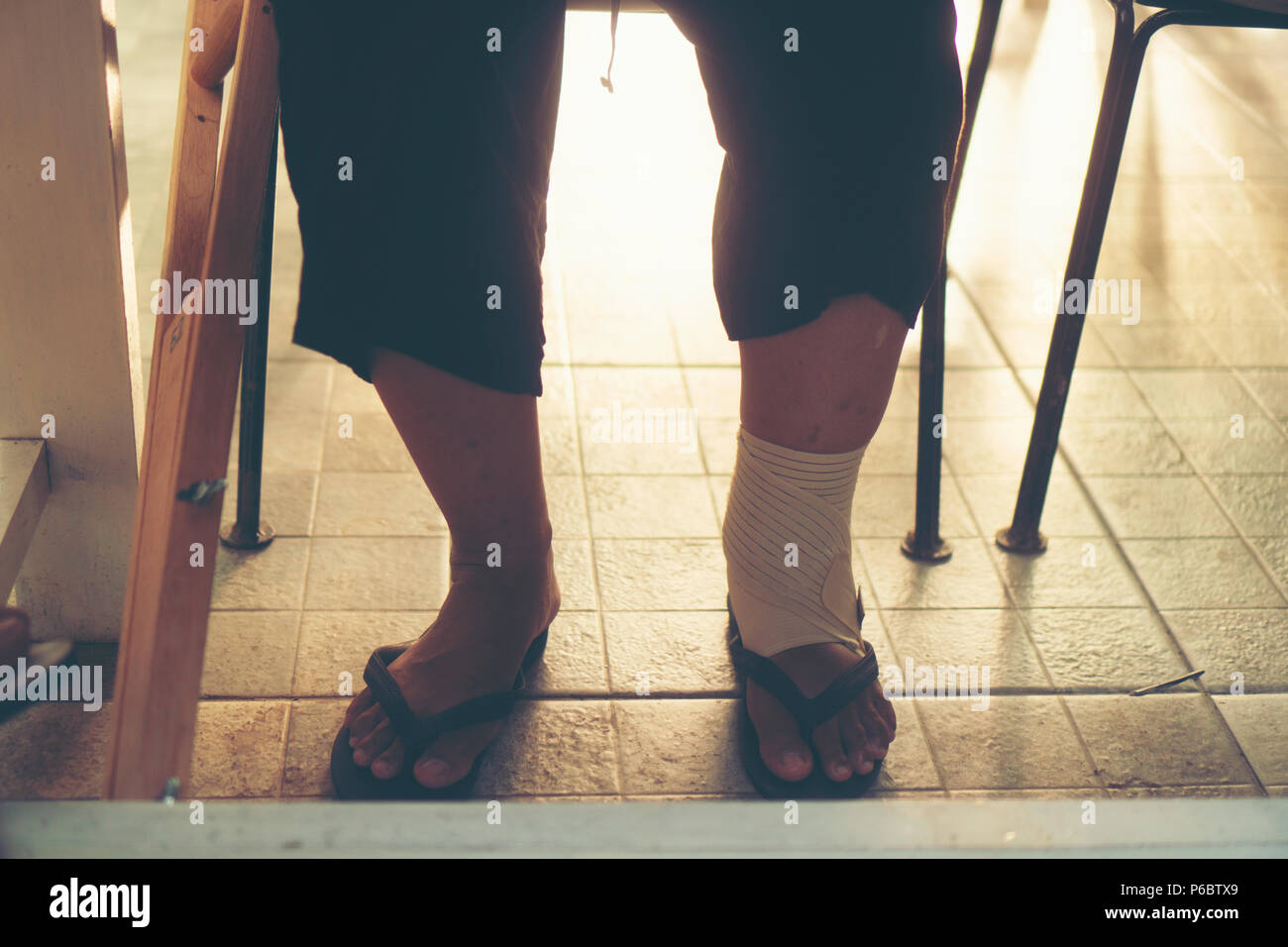 Legs of patients wearing a splint Stock Photo - Alamy
