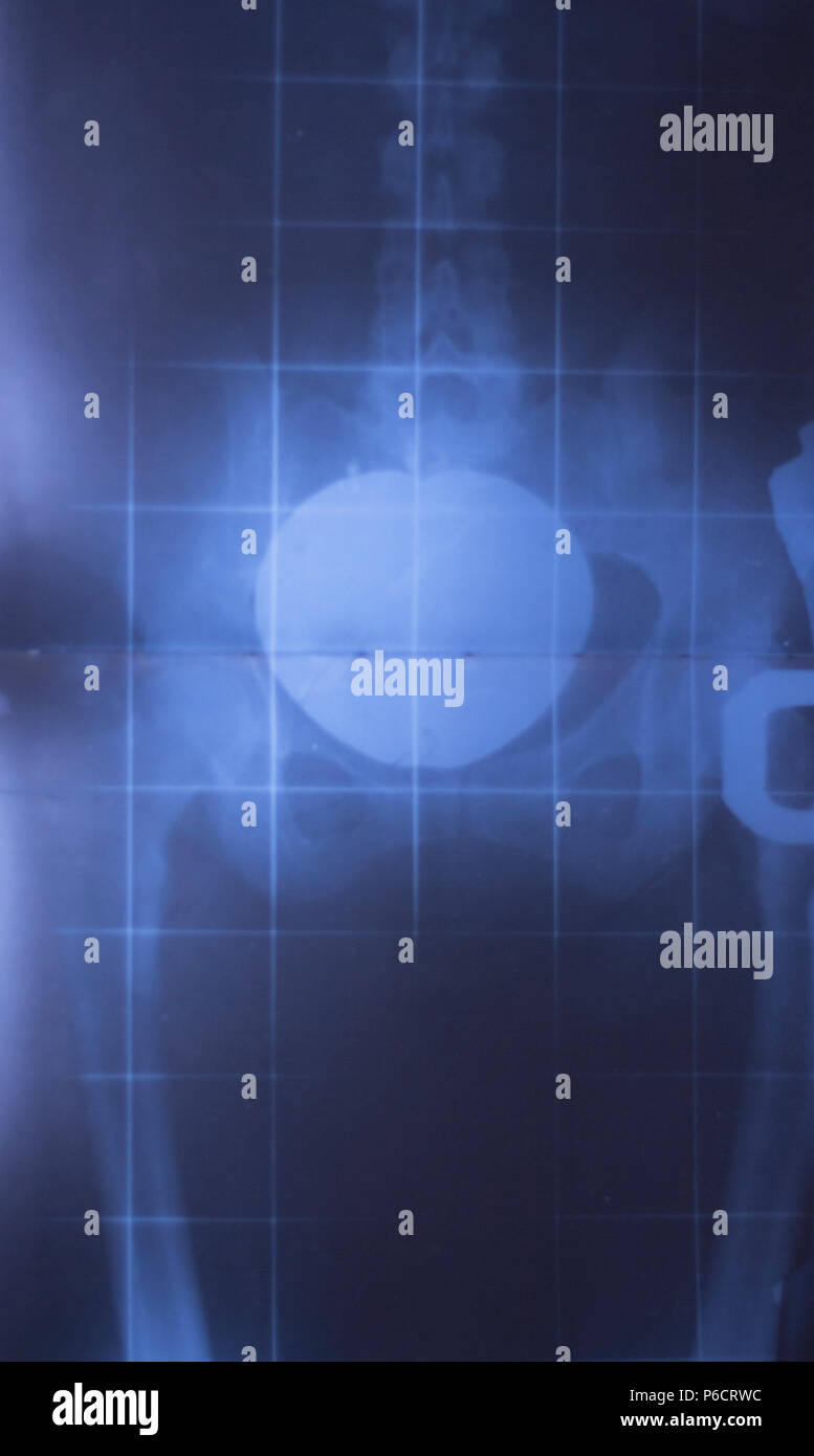 Medical hospital x-ray lowe back pain spine and hips traumatology scan ...