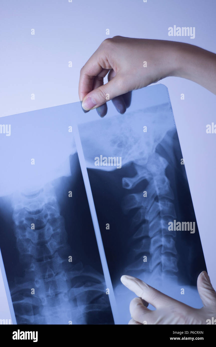 Medical hospital x-ray lowe back pain spine and neck traumatology scan ...