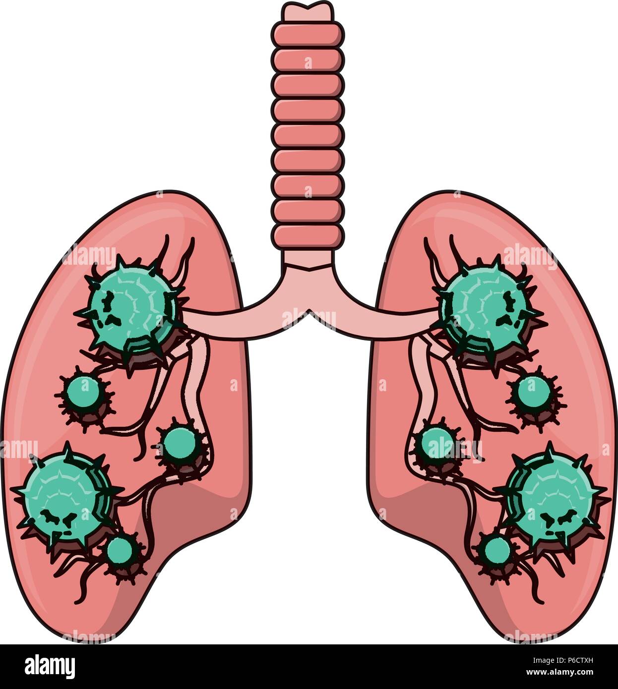 Chest Infection High Resolution Stock Photography and Images - Alamy