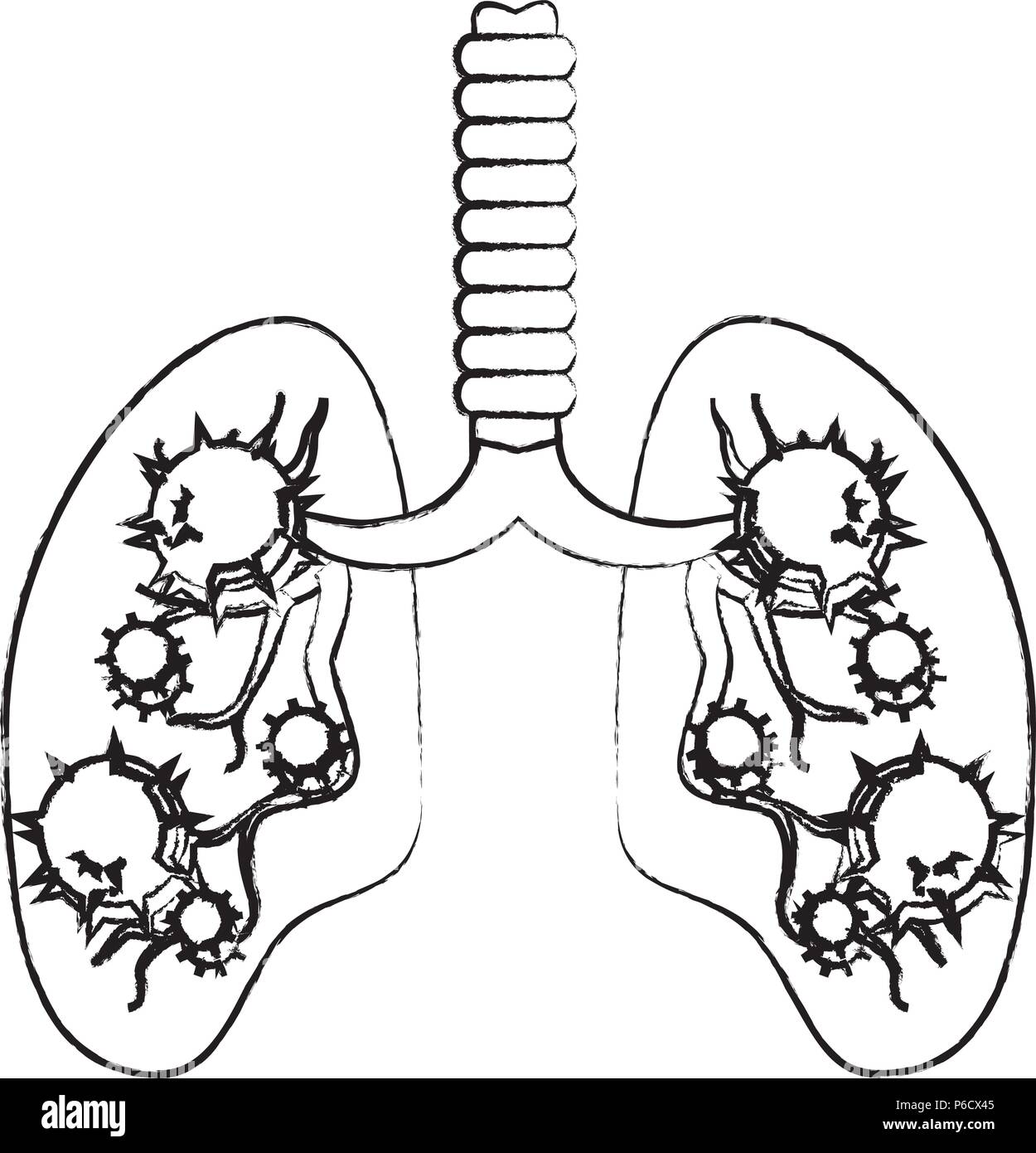 Lungs with an infection over white background, vector illustration ...