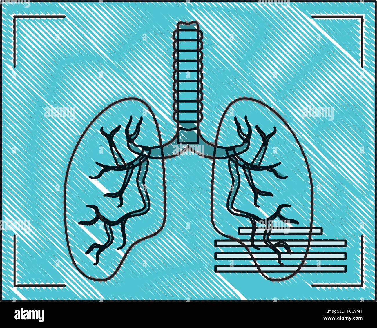 Lungs xray Stock Vector Images - Alamy