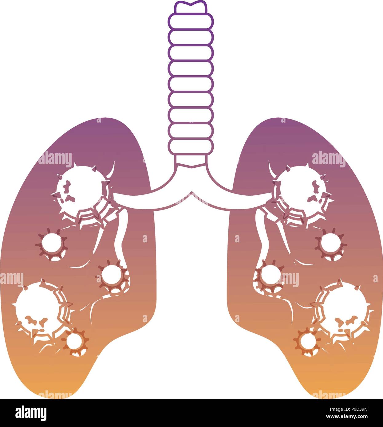 Lungs with an infection over white background, vector illustration ...